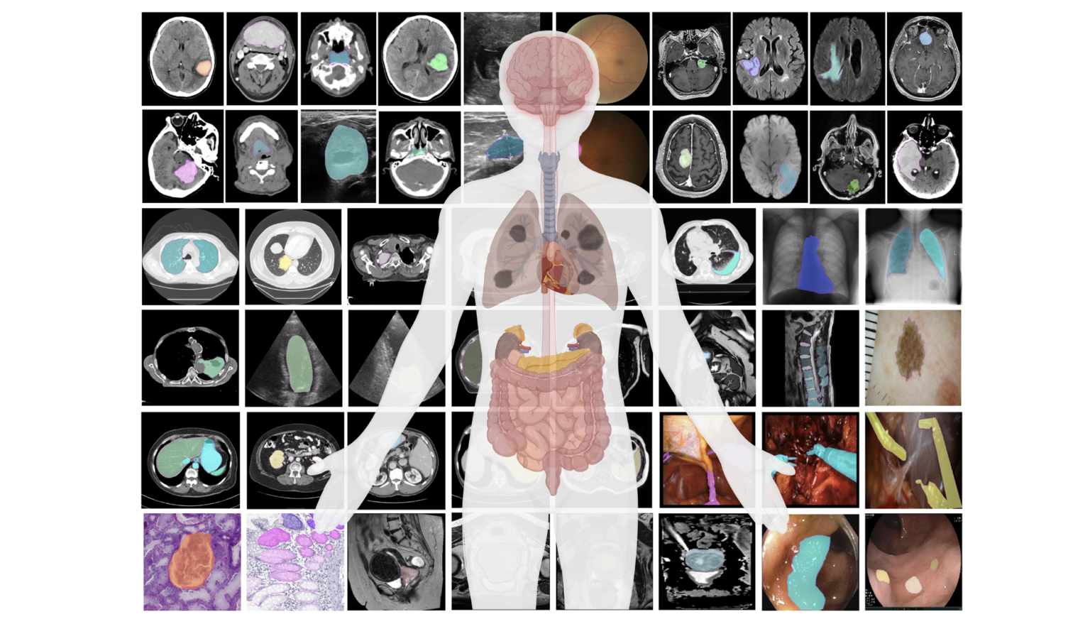 医用画像セグメンテーションにおけるSAMとMedSAMの精度検証および比較 | ai library